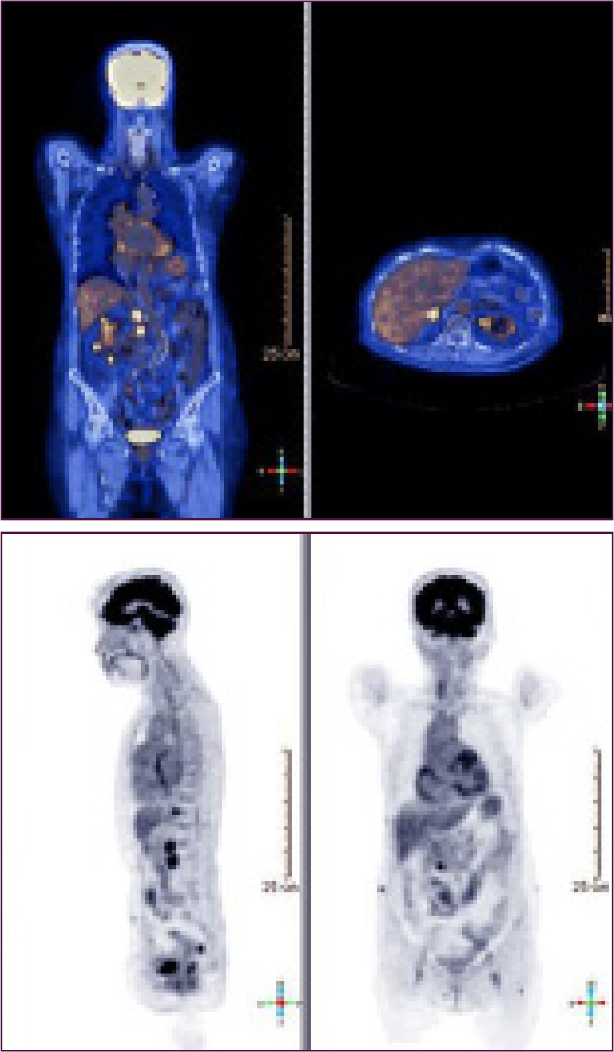 Oncology Medical Imaging Expertise | Clario