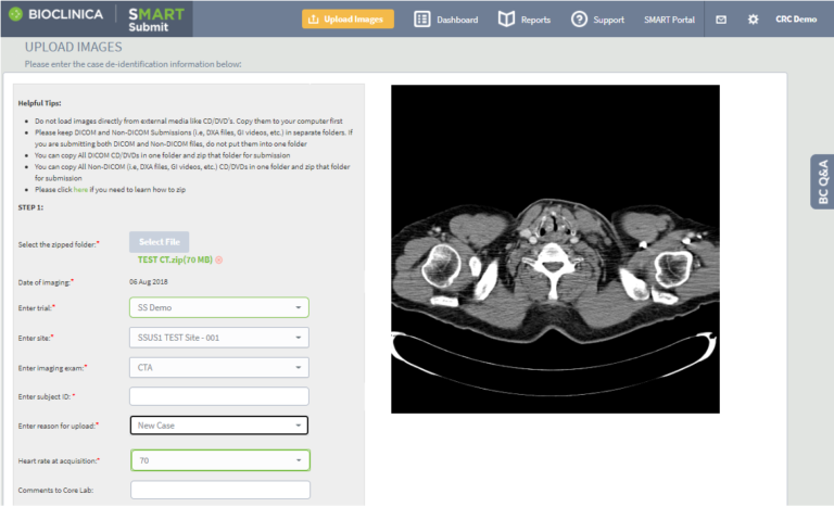 Clario SMART Submit | Clinical Trial DICOM De-Identification