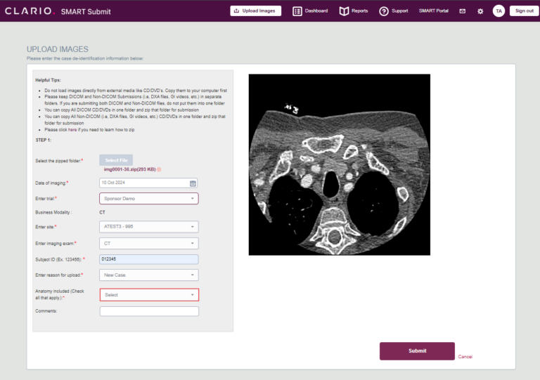 Clario SMART Submit | Clinical Trial DICOM De-Identification