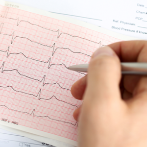 Phase I/TQT Cardiac Assessment | Clario