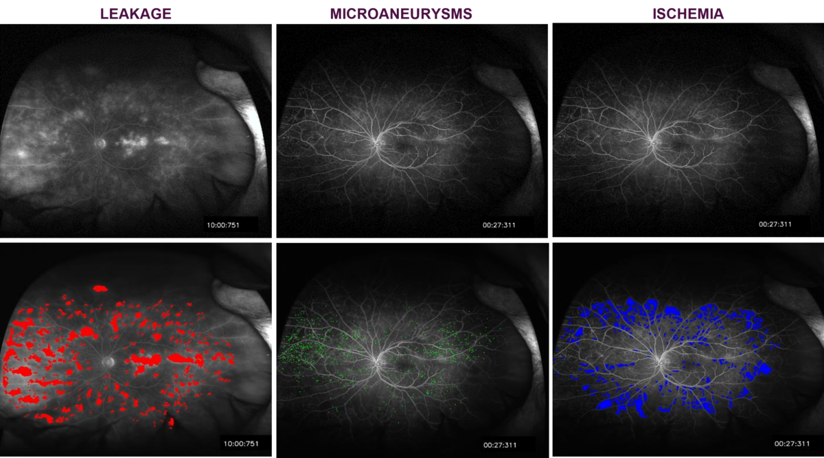 Clario Ophthalmology Imaging │ Clinical Trials