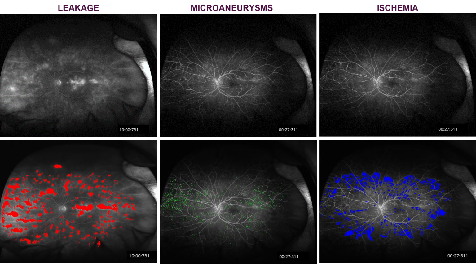 Clario Ophthalmology Imaging │ Clinical Trials