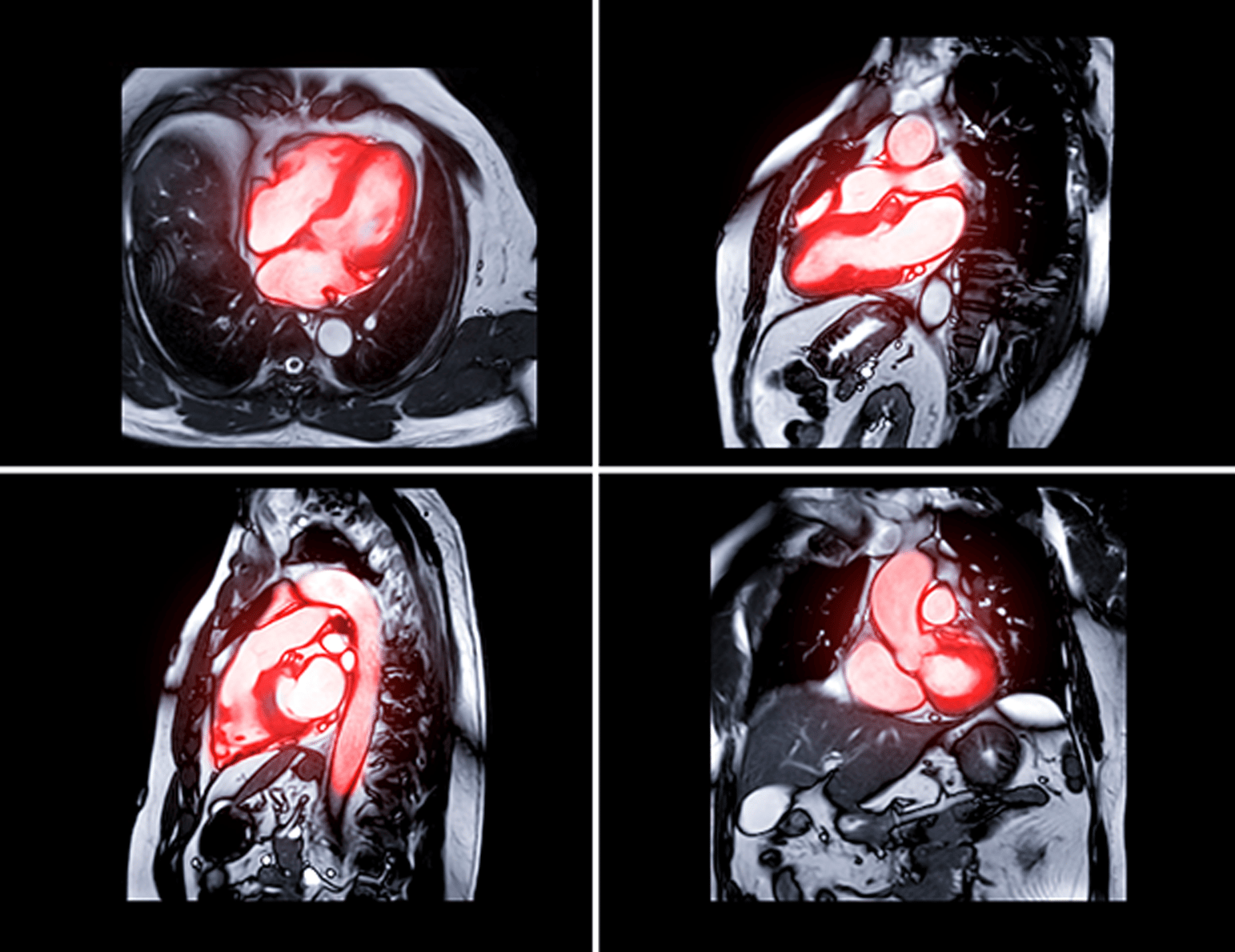 Clario Medical Imaging │ Cardiovascular